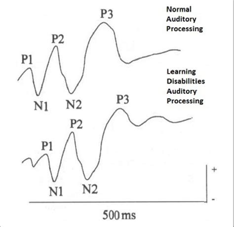 Cognitive Potentials P300 Traces Normal Processing × Non Normal Download Scientific Diagram