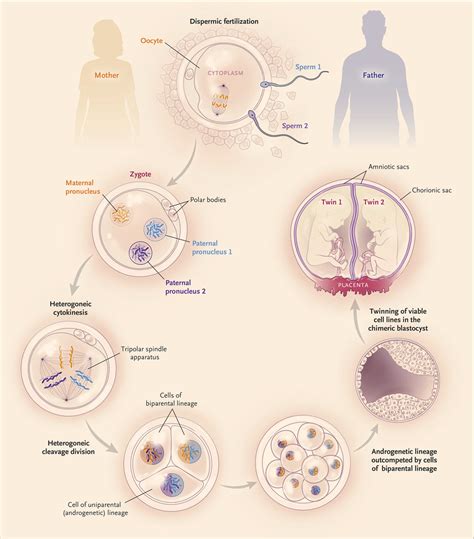 Mixed Chromosome Twins Definition