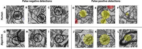 figure 5 from automated detection and segmentation of synaptic contacts