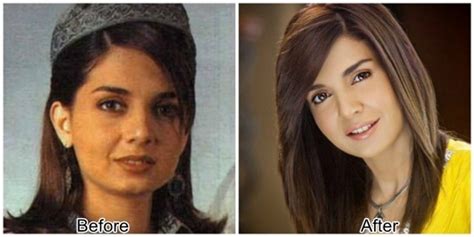 Top 10 Pakistanies Pakistani Actresses After Plastic Surgery