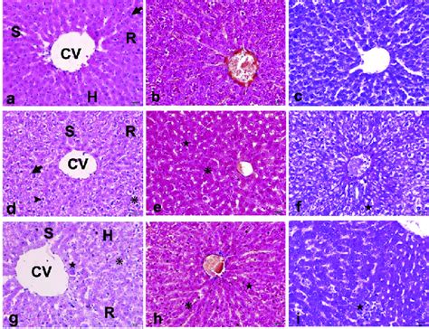 A C Normal Liver Morphology With Central Vein Wellorganized Sinusoids