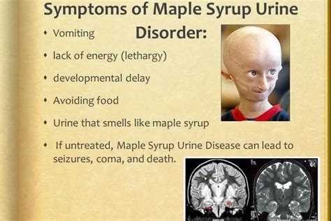Msud Diet Archives Samarpan Physiotherapy Clinic