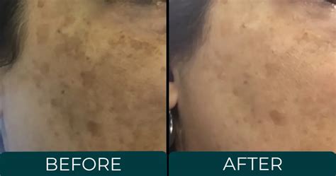 Gallery Vital Clinic And Spa