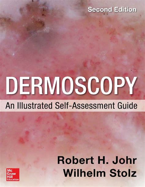 Dermoscopy An Illustrated Self Assessment Guide 2nd 2e