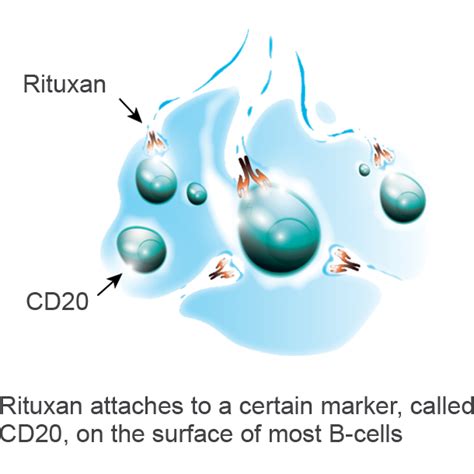 What Is Rituxan® Rituximab For Gpa And Mpa