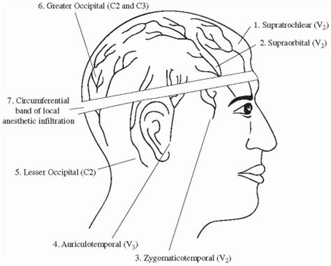 Awake Craniotomy Can Be Done Humanely Anesthesia Key