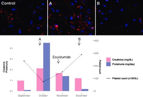 Clinical Case Complement Assessment In Tma For Early Aetiological