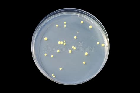 Colonies Of Micrococcus Luteus Bacteria Stock Image Image Of Cocci Growth 149651653
