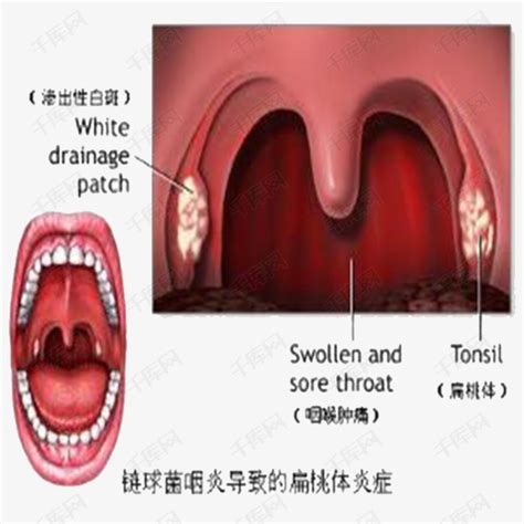 喉咙结构图片大全详细 扁桃体结构高清图片 伤感说说吧