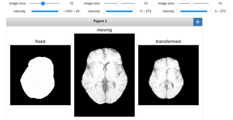 3d Registration Of Anatomical And Functional Mri Of Brain Images