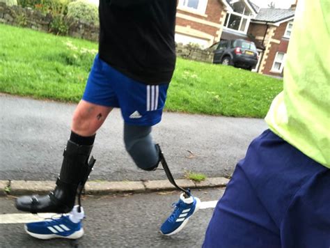 Inspiration Amputee Amputation Sheffield10k Amputeerehab