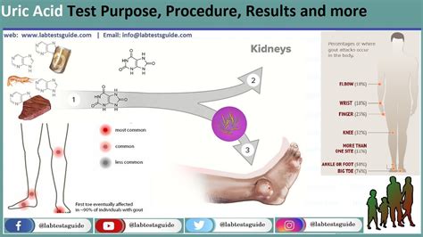Uric Acid Test Purpose Procedure Results And More Lab Tests Guide