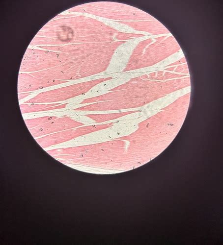 Lab Quiz 2 Flashcards Quizlet
