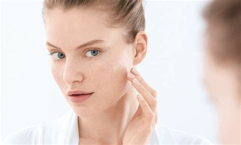 Лекове срещу тъмни петна по кожата Имени дни