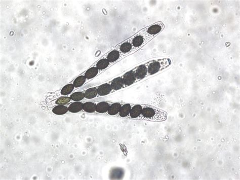 There Are Ascospores In Each Ascus Of Sordaria Fimicola Single Celled Meiosis Cell Division