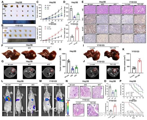 If：29！国自然热点代谢重编程再发高分！南京医科大学王学浩 武汉大学张鹏团队揭示tk1在肝细胞癌中重要作用 知乎