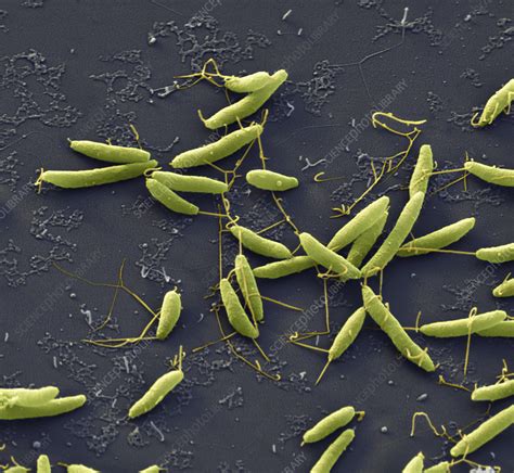 Campylobacter Jejuni Bacteria SEM Stock Image C045 9634 Science