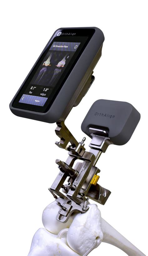 Orthalign Inc Announces First Cases Using Lantern™ Surgical Assistant A Next Generation