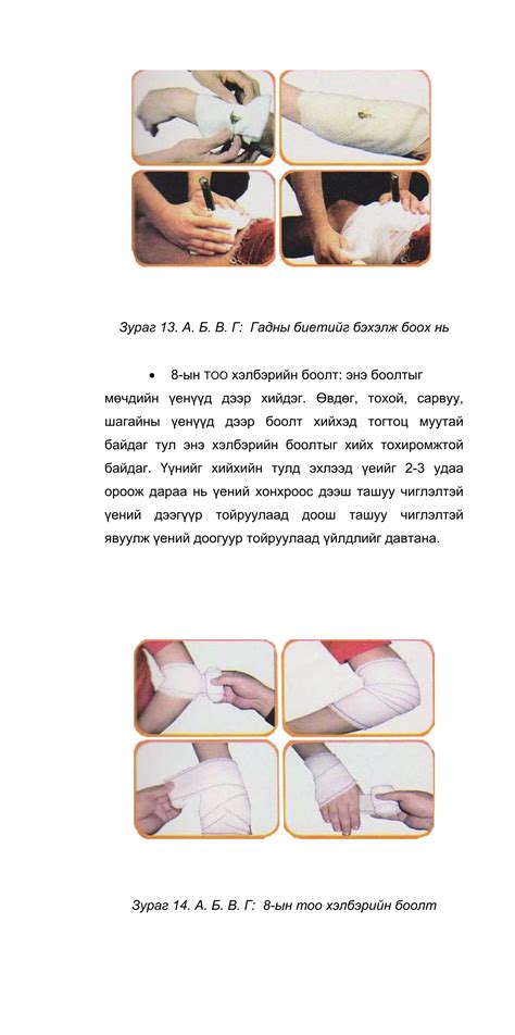 Осол гэмтлийн үед үзүүлэх анхны тусламж Pdf