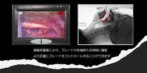 ビデオ喉頭鏡andブレード クリエイトノヴァ株式会社