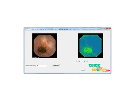 Saliency Based Ulcer Detection For Wireless Capsule Endoscopy Diagnosis
