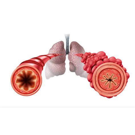 Diacetyl And Popcorn Lung Edge Vaping