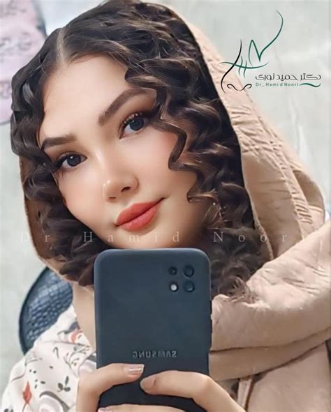 ‎دکتر حمید نوریجراحی زیبایی‎ ‎ ارسالیشما 😍 رضایت زیباجوی عزیز