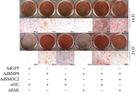 The Activation Of Fak Signaling In The Enhancement Effect Of Smoc2 On
