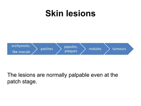 Kaposi Sarcoma Pptx