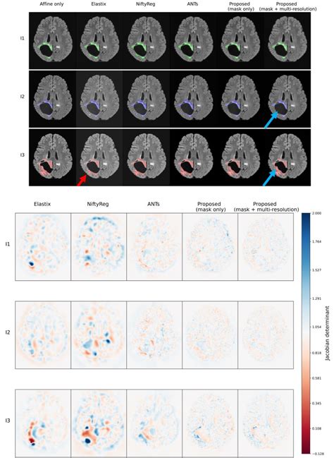 Figure 3 From Deep Learning Based Group Wise Registration For