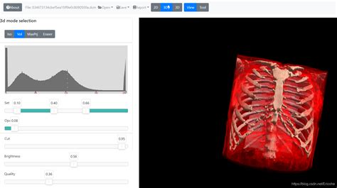 Web Dicom Viewerdicom Web Viewer Csdn博客