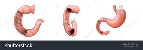 Stomach Duodenum Human Anatomy White Background Stock Illustration 1938527362 Shutterstock