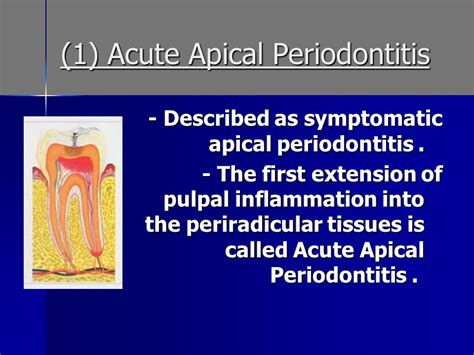 Acute Apical Periodontitis