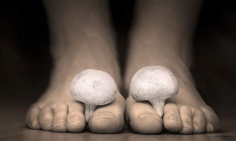 7 Ways To Treat Toenail Fungus Naturally And Effectively
