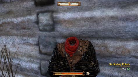 Uuuhhh Sir Radzig You Feeling Ok Rkingdomcome