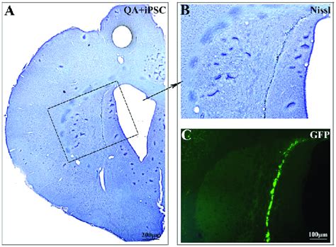 Transplanted Ipsc Migrated Into The Lesioned Striatum After Qa