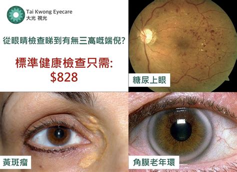 Tai Kwong Eyecare 大光視光 Hong Kong Hong Kong