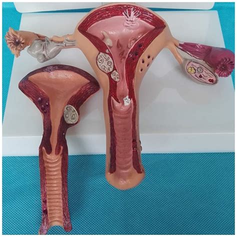 Buy Uterus Model Uterus Ovary Anatomical Model With Pathologies Human Anatomical Uterus Teaching