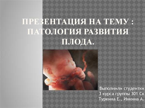 Патология развития плода презентация онлайн