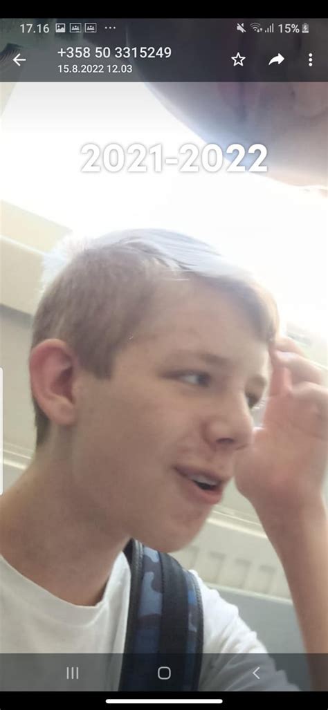 I Think I Might Have Condylar Resorption 15m Rjawsurgery