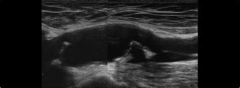 Peripheral Vessels 101 Peripheral Arteries Case 1016 True