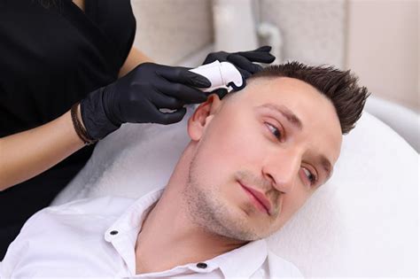 메소 롤러로 미세 니들링 트리트먼트를 받을 수 있습니다 건강관리와 의술에 대한 스톡 사진 및 기타 이미지 건강관리와 의술 더마롤러 디자인 Istock