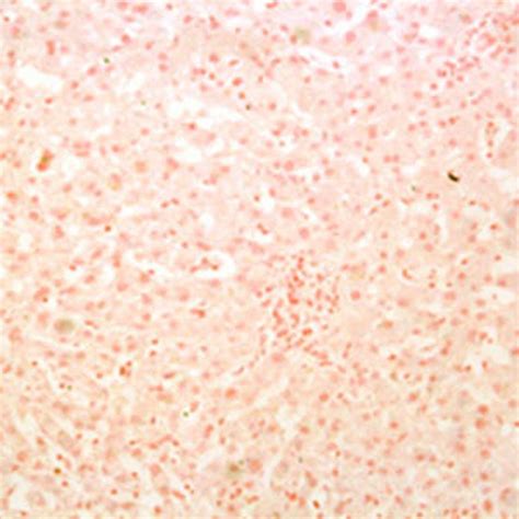 Eosine Solution Alcoolique 05