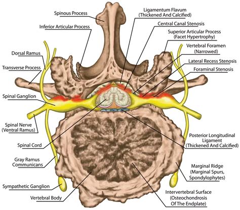 What Is The Best Treatment For Spinal Stenosis Premia Spine