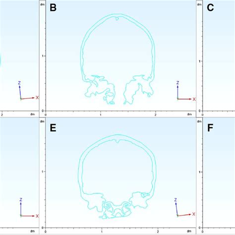 Coronal Section Of The Skull The Coronal Sections Across The Bilateral