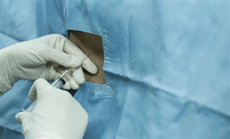 警惕有这些症状说明慢性粒细胞白血病加重急变了 治疗 患者 病例