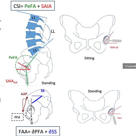 Illustration Of Pelvic And Spinal Parameters Assessed In This Study