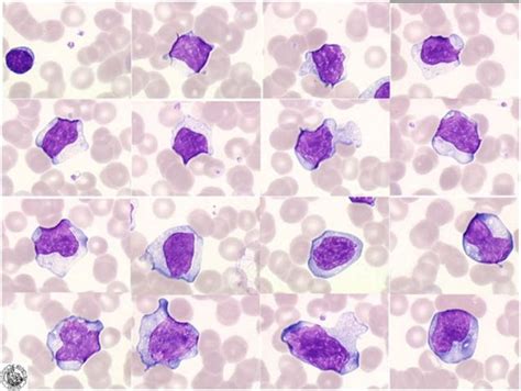 Laboratoire Dhématologie Cellulaire Du Chu Dangers Hématologie