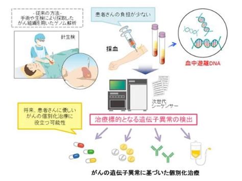 血液でがんゲノム解析、すい臓がんで成果：医療：日経デジタルヘルス