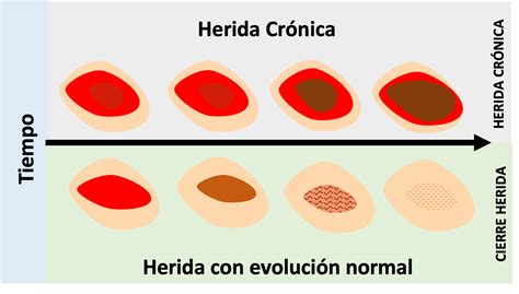 Tipos De Heridas En La Piel